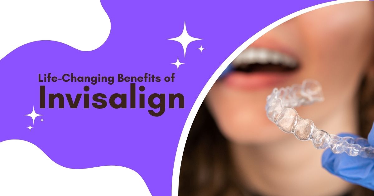 The Benefits Of Invisalign | White House Dental